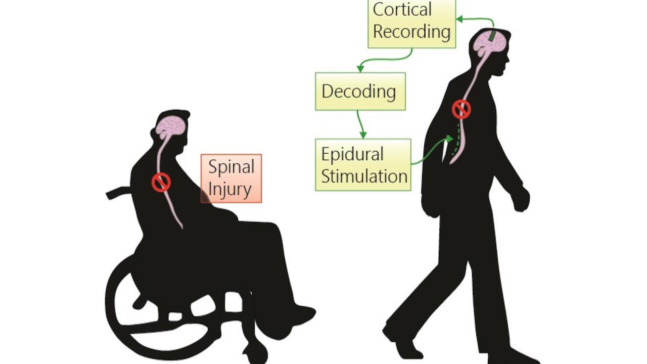 UC Davis Engineers Lead $36M Effort to Improve Recovery From Spinal ...